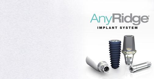 Имплантация Any Ridge - Качественные корейские импланты по доступной цене