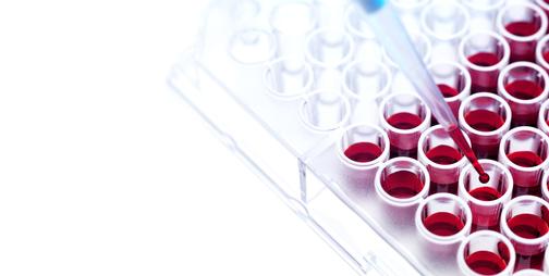 Исследования крови