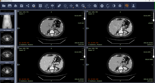Просмотровщики медицинских изображений
